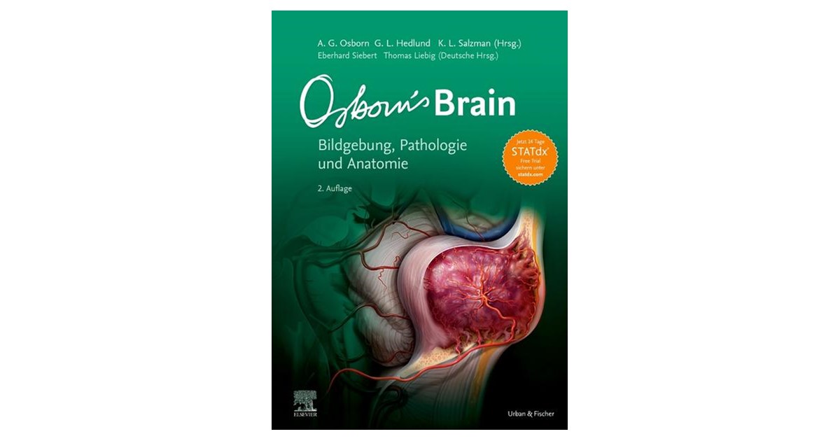 Osborn / Hedlund | Osborn's Brain | 2. Auflage | 2019 | beck-shop.de