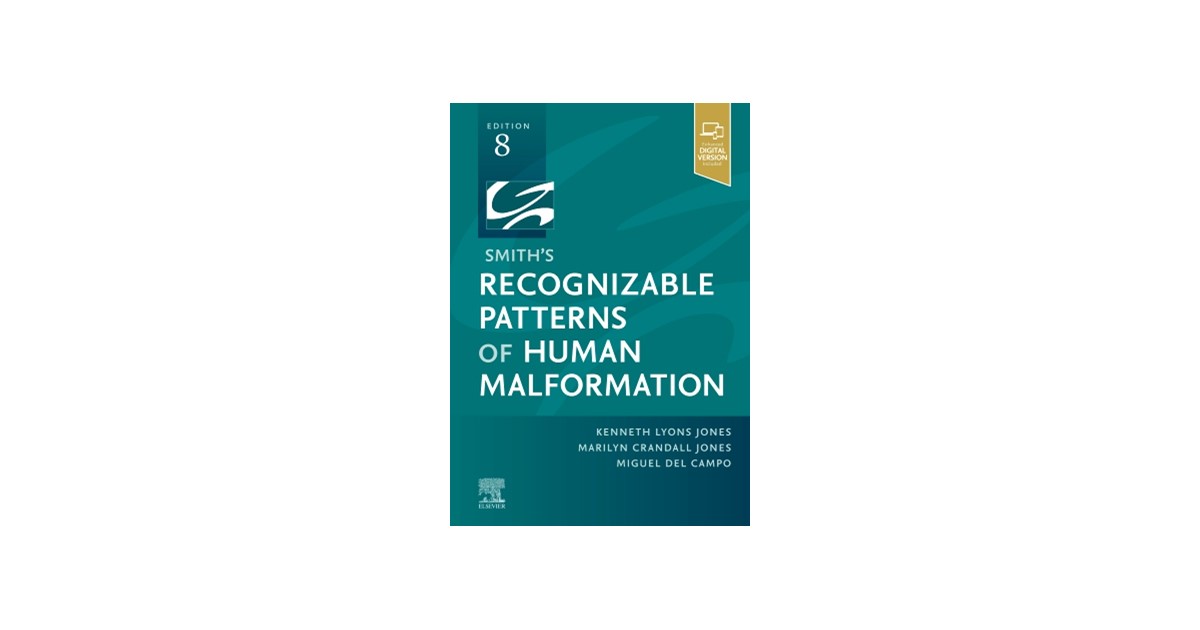Jones / del Campo | Smith's Recognizable Patterns of Human Malformation ...
