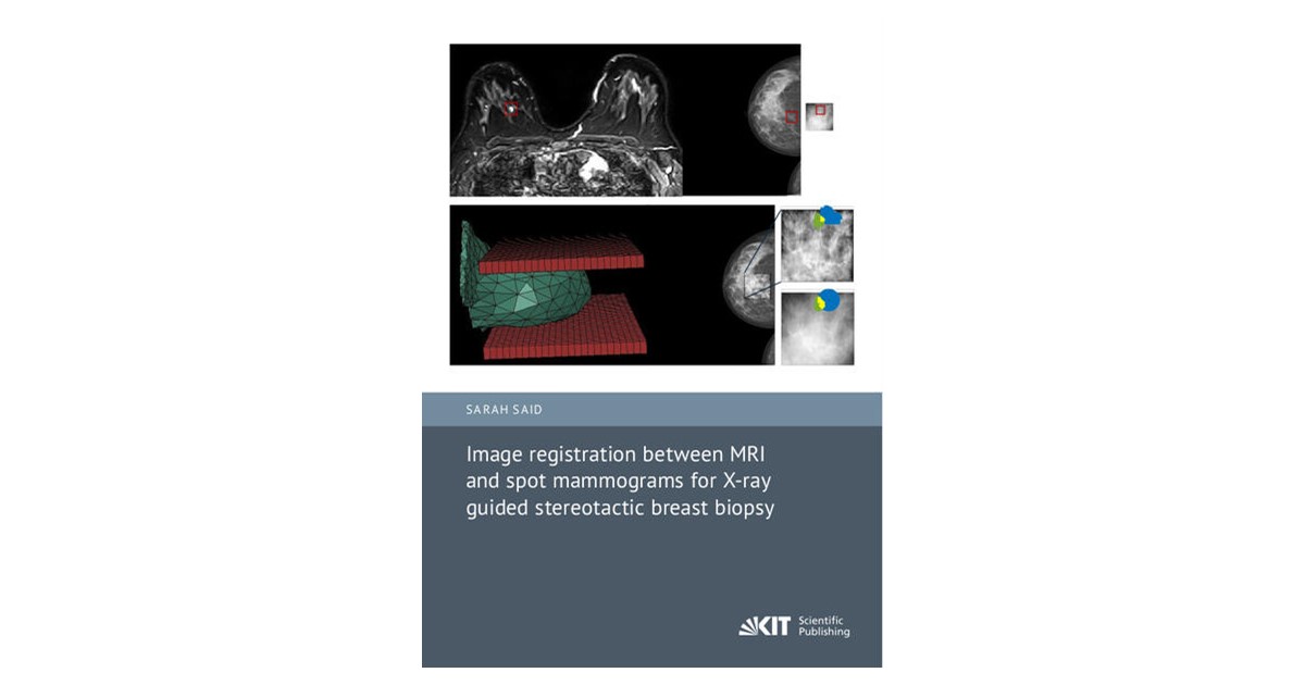 Said | Image registration between MRI and spot mammograms for X-ray ...