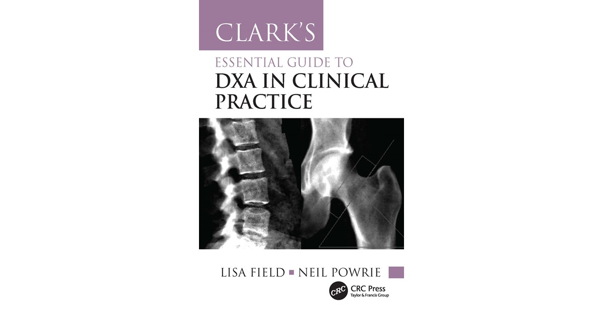 Field / Powrie | Clark's Essential Guide to DXA in Clinical Practice ...